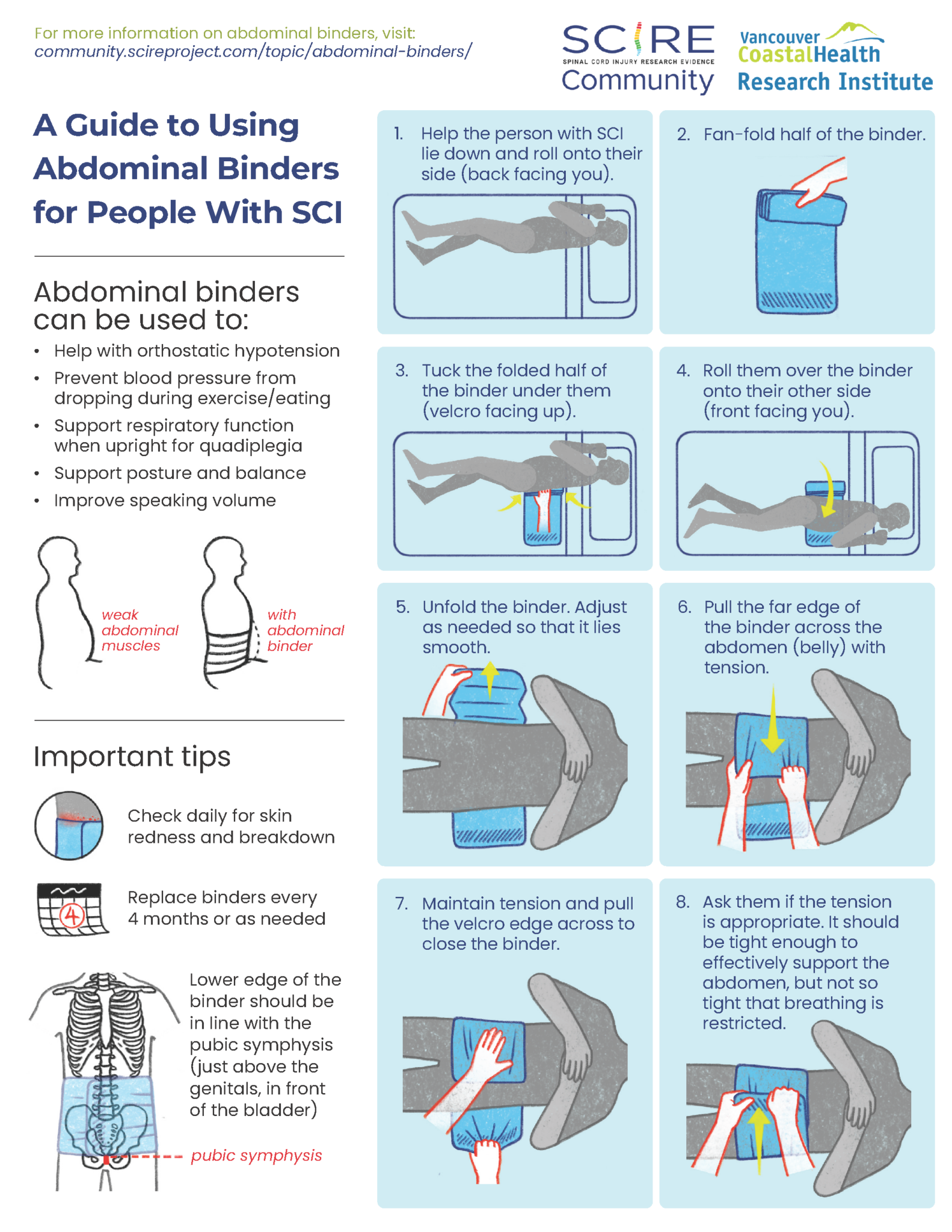 Abdominal Binders - SCIRE Community
