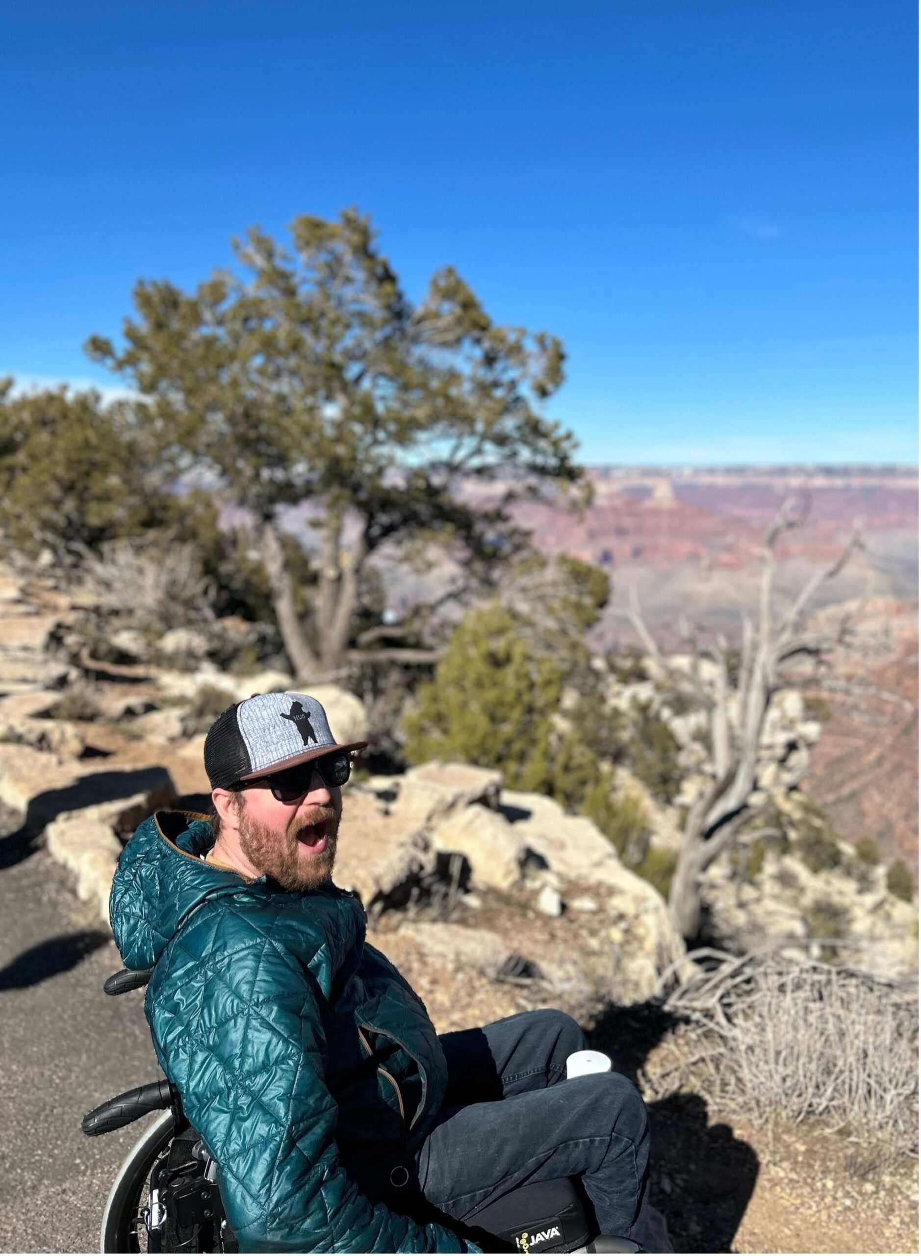 Nerve Transfer Surgery - SCIRE Community